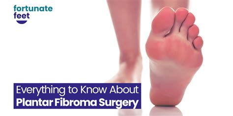 Plantar Fibroma Pictures Treatment Surgery Symptoms