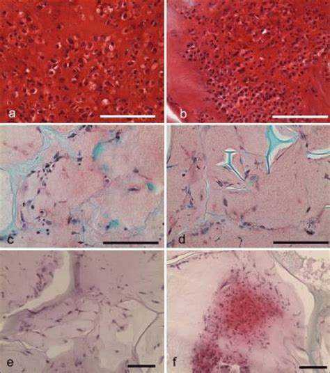 Light Micrographs Of Chondrocyte Seeded Scaffolds Following 2 Week