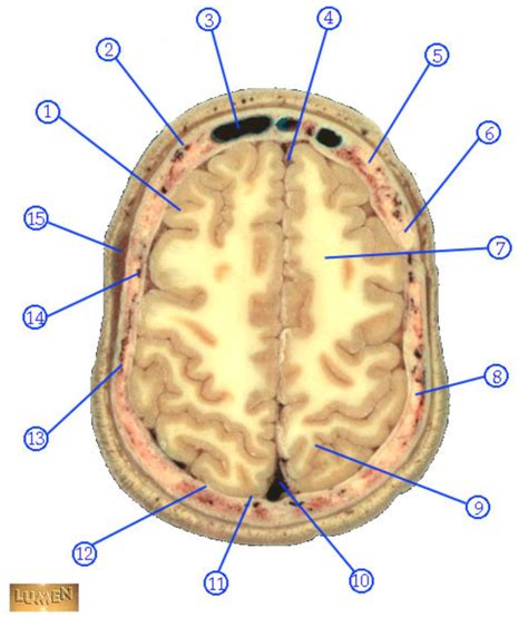 Transverse Axial Anatomy Of Head Transverse Axial Section 1