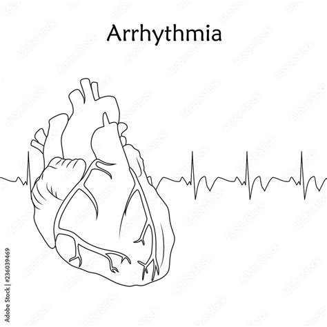 Vecteur Stock Human Heart Arrhythmia Anatomy Flat Illustration Outline Image White