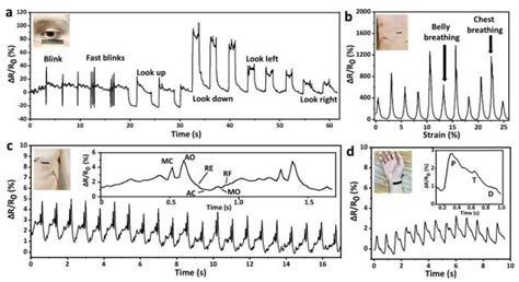 Lignin Derived Porous Graphene For Wearable And Ultrasensitive Strain Sensors Qian Wu 吳謙