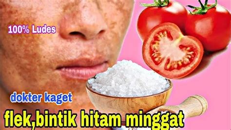 Cara Cepat Mengatasi Bintik Hitam Di Wajah Paling Ampuh Cuma Bahan Ini Bikin Wajah Glowing