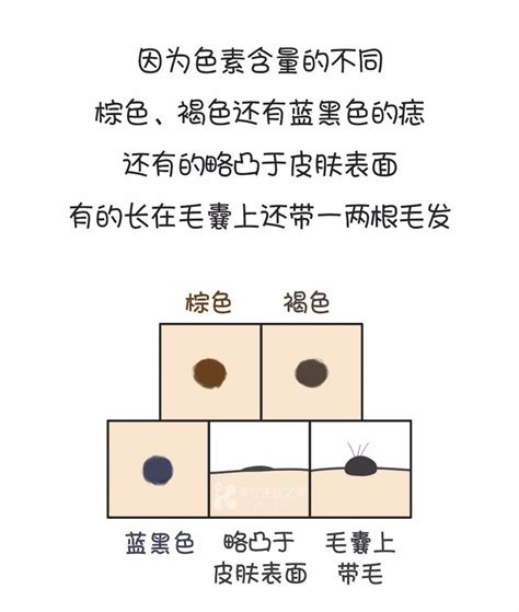 一顆「痣」是如何滑向癌變深淵的 壹讀