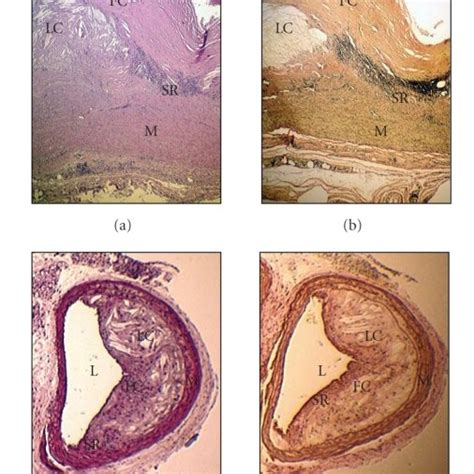 Schematic Representation Of The Low Density Lipoprotein Particle Ldl Download Scientific