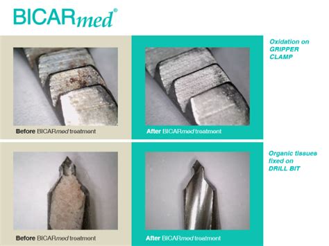 New Revolutionary Pre Cleaning System That Improves Surgical Instrument Reprocessing