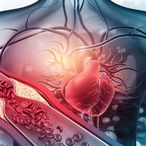 Heart Disease Classification Dataset Kaggle