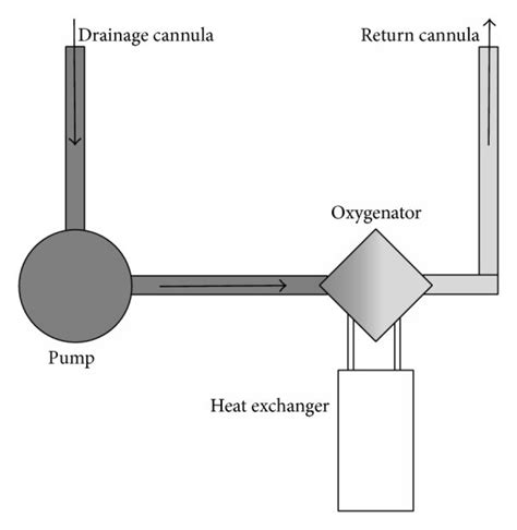 Basic Vv Ecmo Setup Download Scientific Diagram
