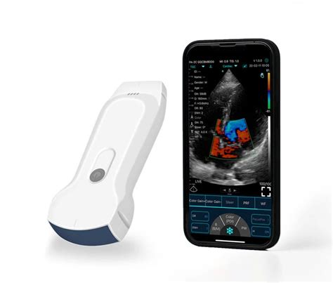 Konted C10rl 3 In 1 Ultrasound Scanner Dual Linear Convex Portable