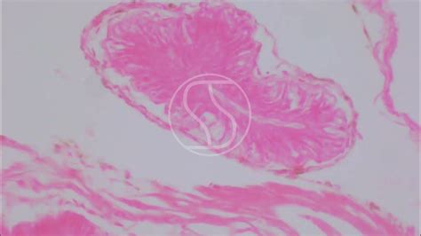 Schistosoma Mansoni Sporocyst With Haematoxylin And Eosin Hande Stain