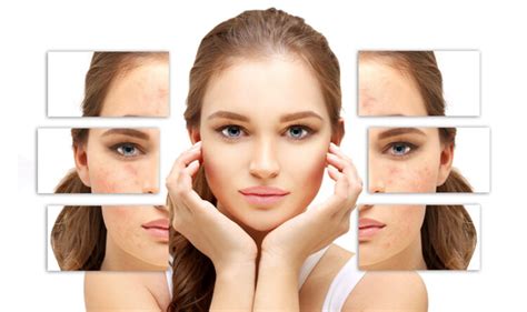 Want To Shrink Your Pores Easily 7 Proven Ways How To Shrink Pores