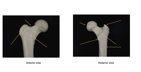 Right Femur Proximal End Diagram Quizlet
