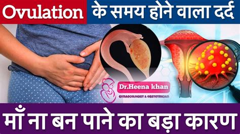 “ovulation Ke Dauran Dard Kya Yeh Normal Hai” Youtube