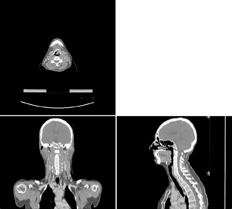 Python How To Extract An Axial Image From The SLIVER07 CT Scan
