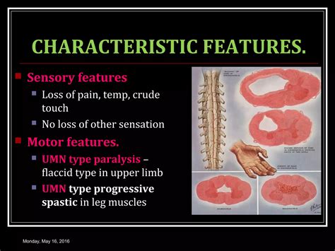 MOTOR SYSTEM SPINAL CORD PPT