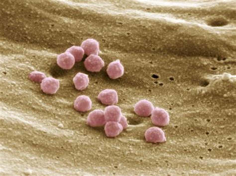 Infections Latentes Et Maladies Sexuellement Transmissibles