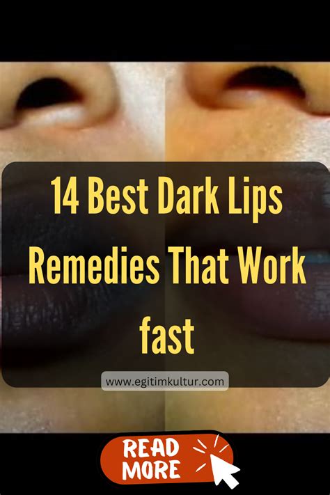 14 Best Dark Lips Remedies That Work Fast EĞİtİm KÜltÜr