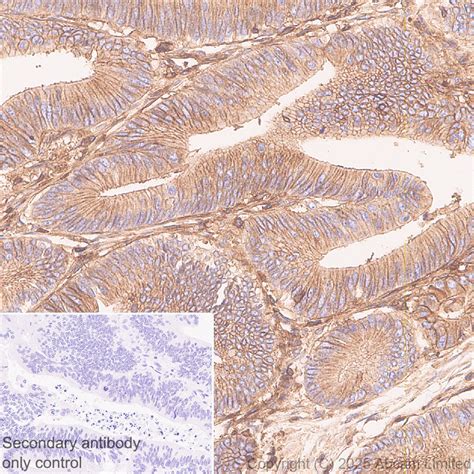 Anti Hla Class 1 Abcg Antibody Epr29051 62 Ab323616 Abcam
