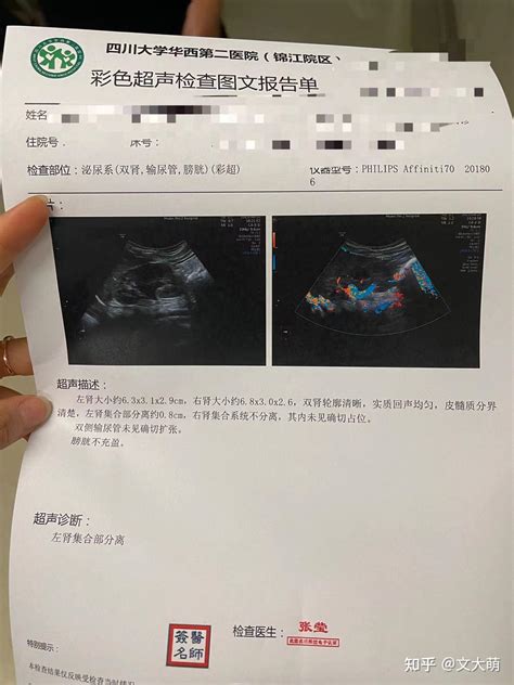 1岁女肾积水重疾标体上岸 知乎
