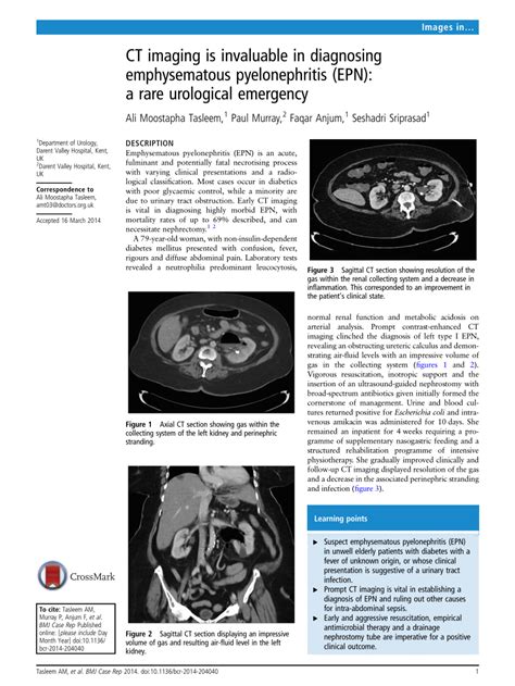 Pdf Ct Imaging Is Invaluable In Diagnosing Emphysematous Pyelonephritis Epn A Rare