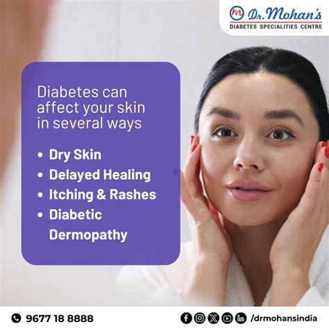 Drmohans Diabetes Specialities Centre On Linkedin Diabetesawareness