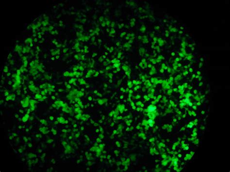 why hek293 cells became circular after transfection researchgate