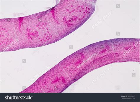 Taenia Solium Parasite Under Microscope Foto De Stock 520329163