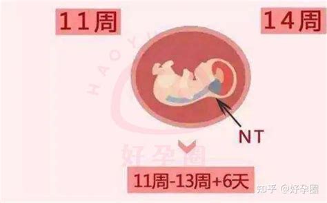 深圳百合医院产检项目及产检时间表整理 知乎