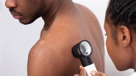 How To Spot Skin Cancer Symptoms Treatment And Protection Health Hindustan Times