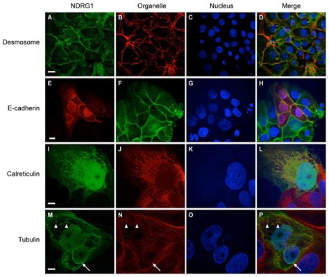 The Expression Of Ndrg1 In Cytoplasmic Membranes Or Membrane Associated