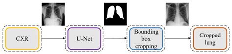 Improved Semantic Segmentation Of Tuberculosis—consistent Findings In Chest X Rays Using