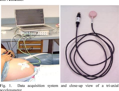 Figure 1 From Accelerometer Based Fetal Movement Detection Semantic Scholar