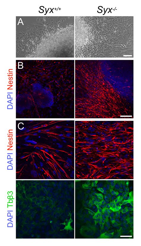 Analysis Of Retinoic Acid Induced Neural Differentiation Of Mouse