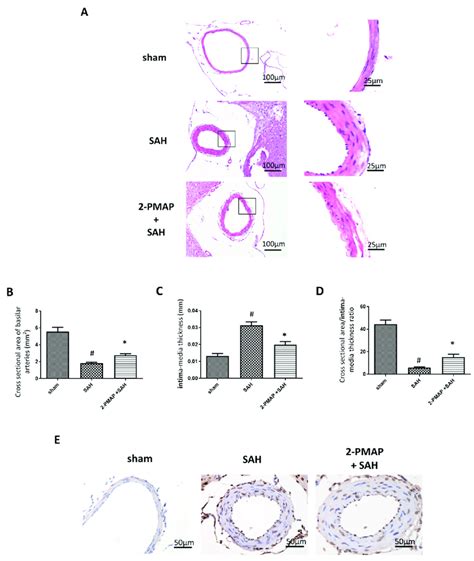 2 Pmap Reduced Vasospasm Severity In Sah Rats A Representative Download Scientific Diagram