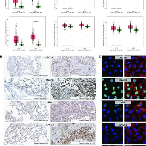 Mrna And Protein Expression Levels Of The Prognostic Ddr Related