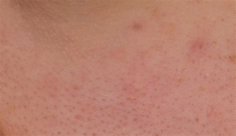 Female 092 Albedo Map