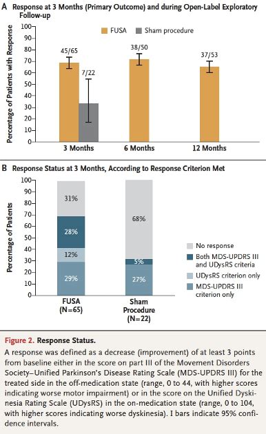 Trial Of Globus Pallidus Focused Ultrasou Cure Parkinsons