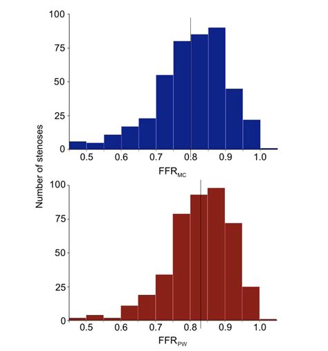Histograms Of Pressure Wire Ffr Values For Ffr Mc And Ffr Pw These