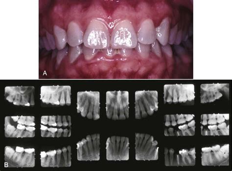 3 Classification Of Diseases And Conditions Affecting The Periodontium