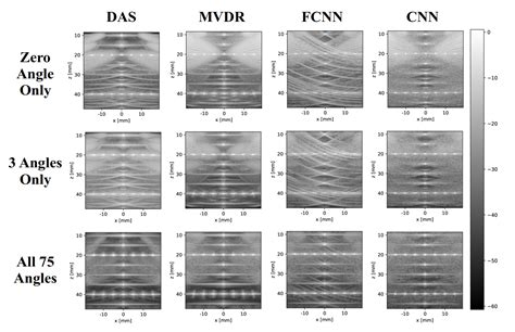 Github Rpm1412cnnusbf An Implementation Of The Network In The Paper