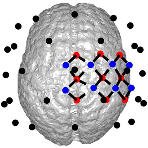 Placement Of Eeg Electrodes And And Dot Probes Black Dots Eeg