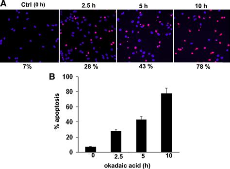 Inhibition Of Pp2a By Oa Increases Apoptosis In A Time Dependent