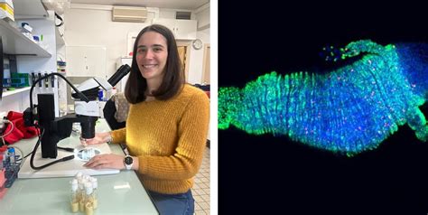 Sex Specific Tumor Formation In The Gut With Charlène Clot Ibv