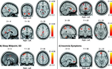 Associations Between Reactive Cognitive Control Processing And Sleep Download Scientific