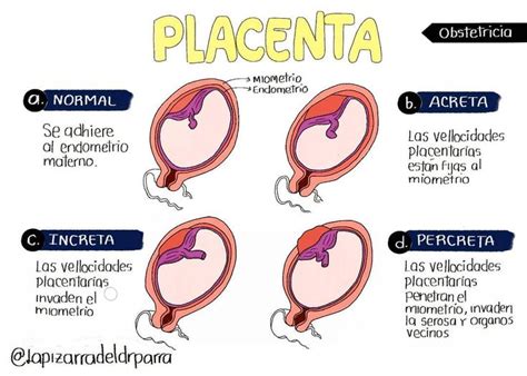 👨‍🏫 ImplantaciÓn De La Placenta 🤰📚 Enfermero Enfermería