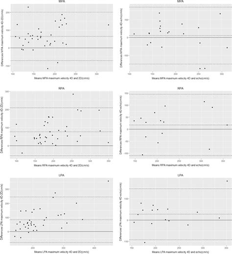 Agreement Between Four Dimensional Flow Cardiac Magnetic Resonance And