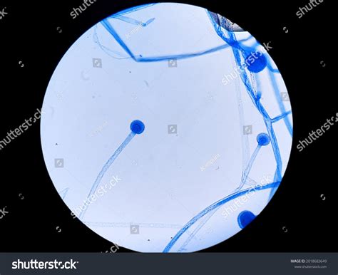 Mucor Sp