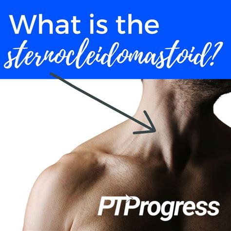 All Concerning The Sternocleidomastoid Muscle Anatomy And Therapy My