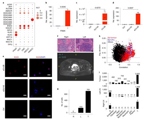 Nat Cell Biol 前列腺癌单细胞分析揭示不同类型转录谱对侵袭的影响 知乎