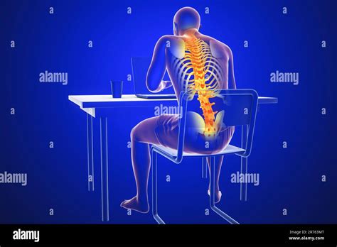 Working With Laptop In A Wrong Position Concept Of Back Pain Computer