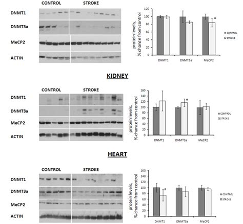 Expression Of Dna Methyltransferases And Methyl Binding Protein Mecp2